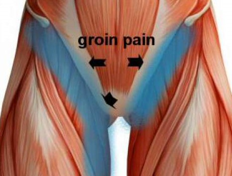 How to Prevent the Most Common Soccer Training Injuries